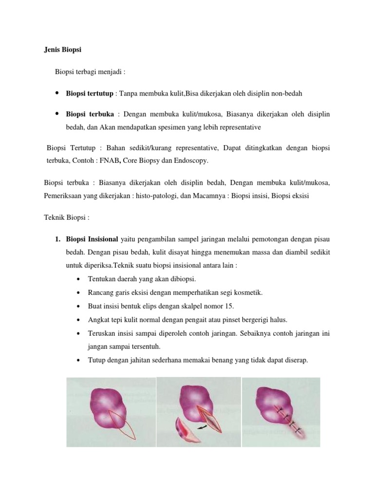 Jenis Biopsi | PDF | Pengembangan Diri | Kesehatan Holistik