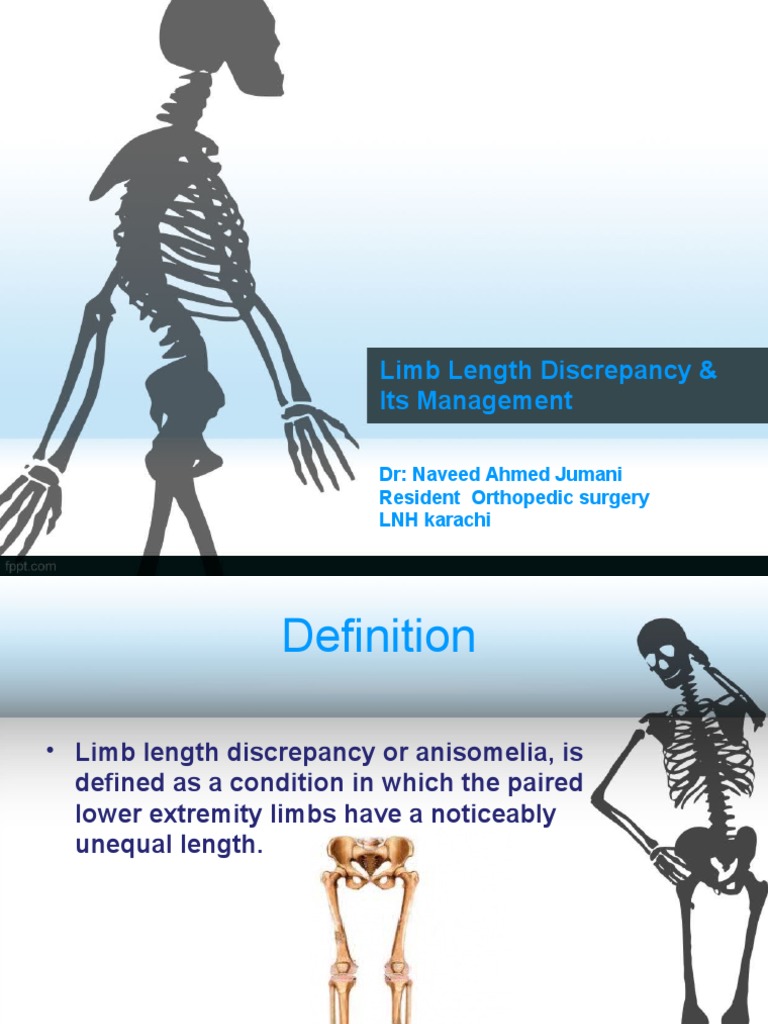Managing Limb Length Discrepancy | PDF | Clinical Medicine ...