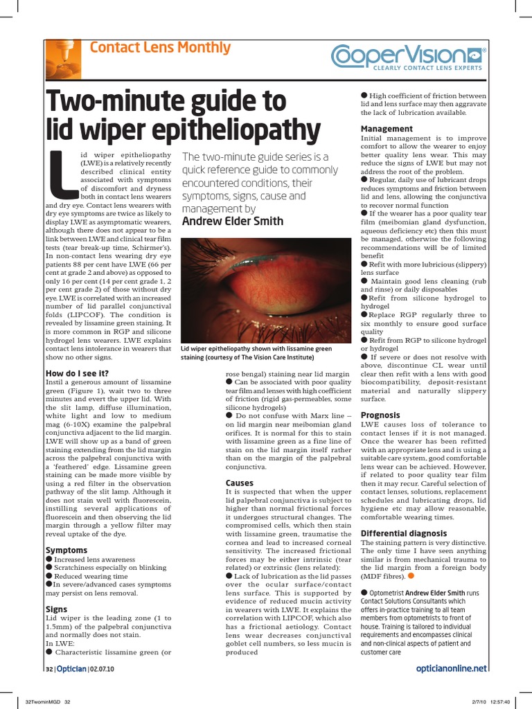 Lid Wiper Epitheliopathy | Contact Lens | Vision