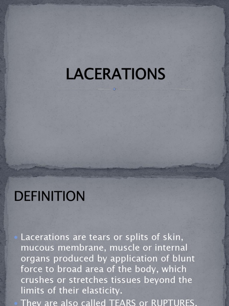 Classification and Characteristics of Lacerations Caused by Blunt Force ...