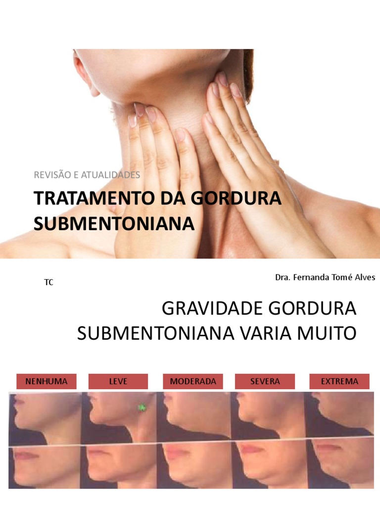 Tratamento Da Gordura Submentoniana | PDF | Remédio | Medicina Clínica
