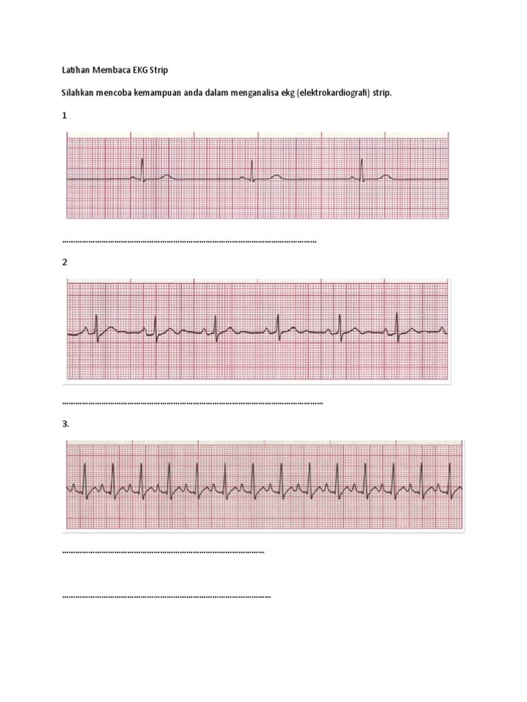 Latihan Membaca EKG Strip | PDF