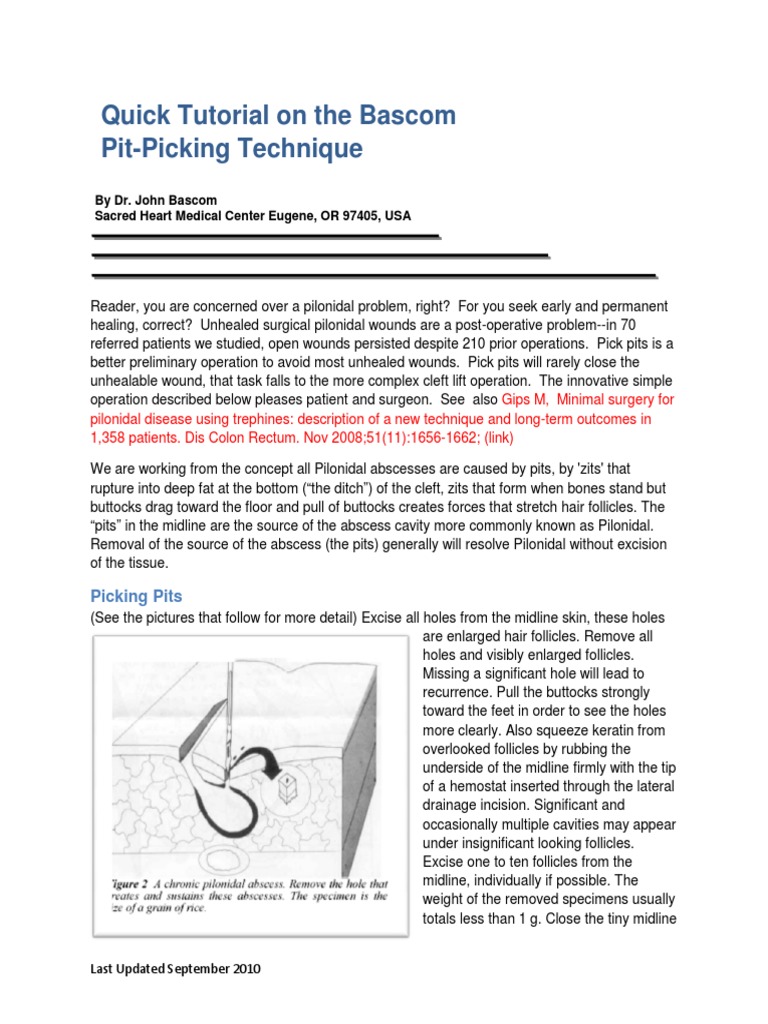 Pit Picking Quick Tutorial | PDF | Clinical Medicine | Medical Specialties