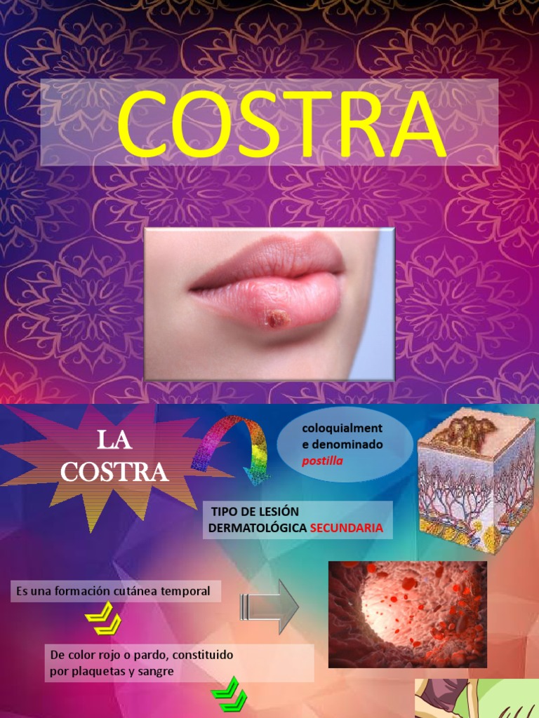 Costras: Formación y Tipos en Piel | PDF | Piel | Medicina
