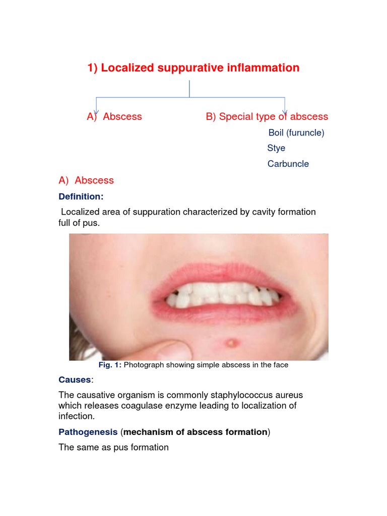 1) Localized Suppurative Inflammation: A) Abscess B) Special Type of ...