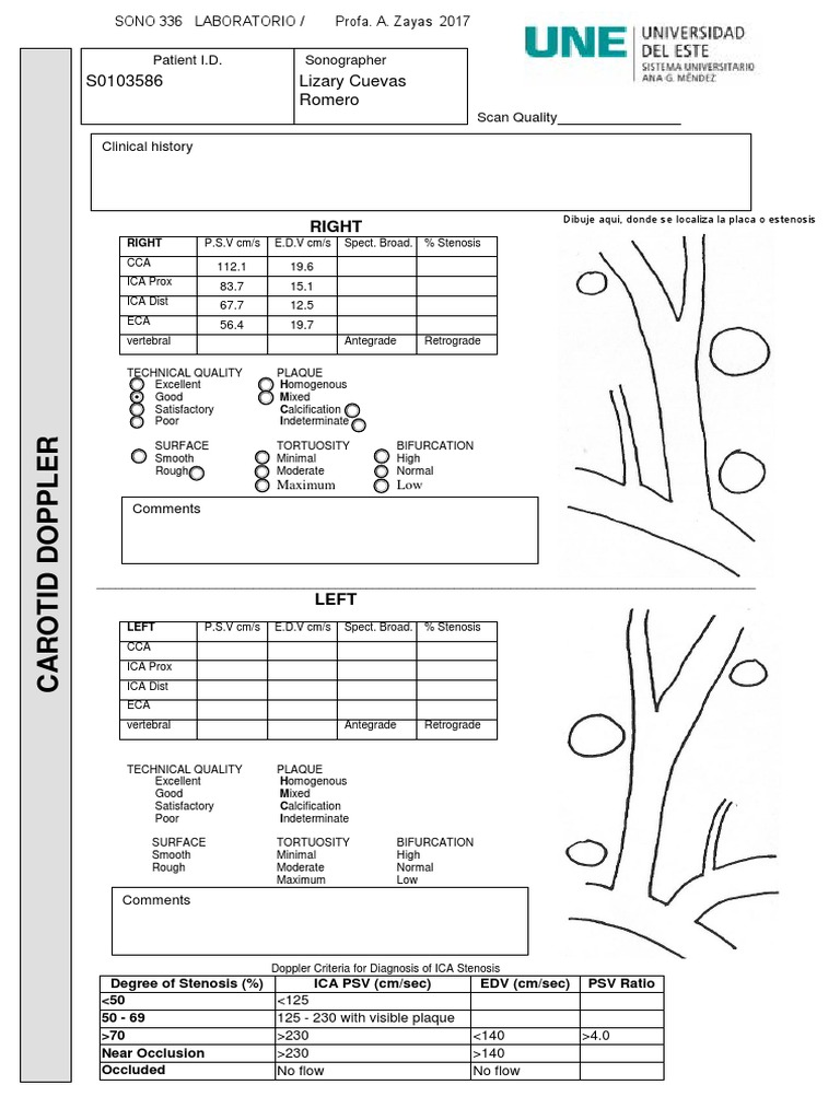 Sono 336 Carotid-Worksheet 1 | PDF | Angiology | Diseases And Disorders