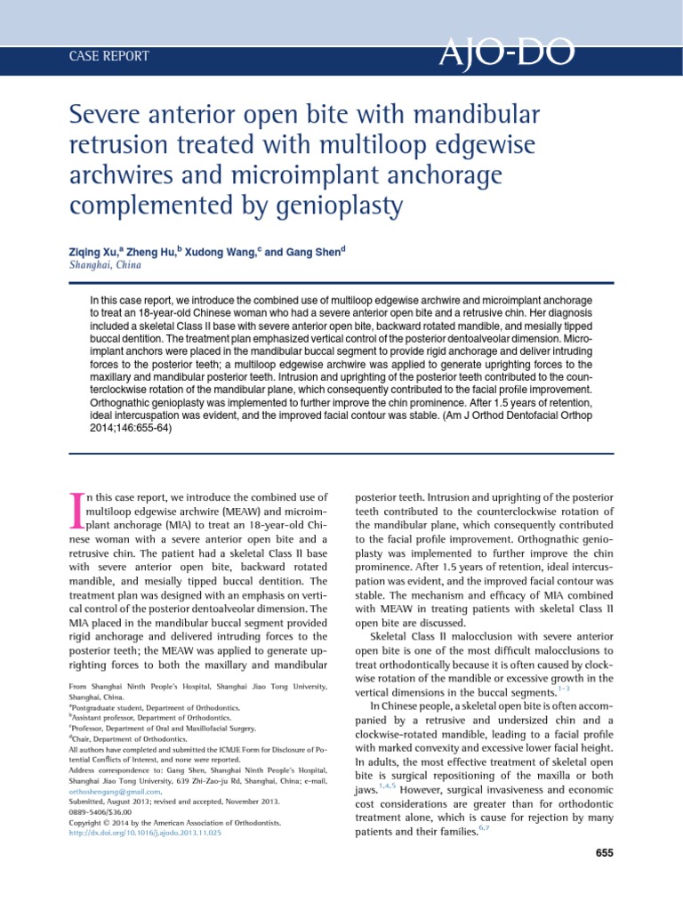 Severe Anterior Open Bite With Mandibular Retrusion Treated With ...