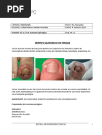 Onicofosis: Causas y Tratamiento | PDF