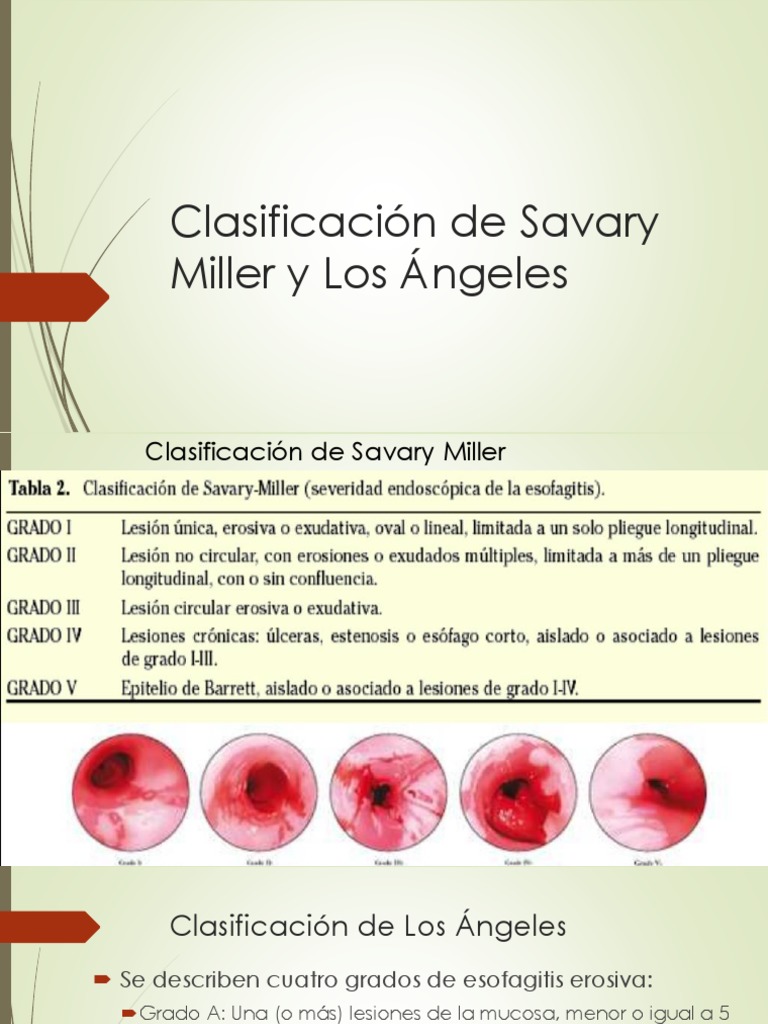 Clasificación de Savary Miller y Los Ángeles | Enfermedad del reflujo ...