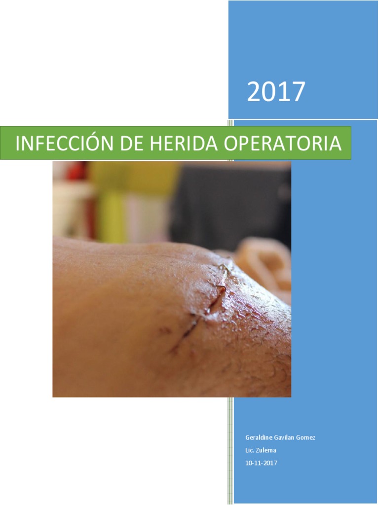 Infección de Herida Operatoria | Herida | Mycobacterium