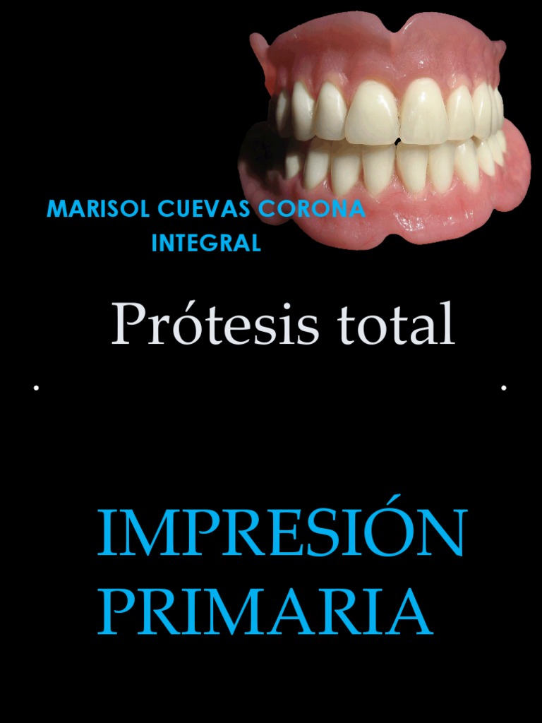 Prótesis Total | PDF