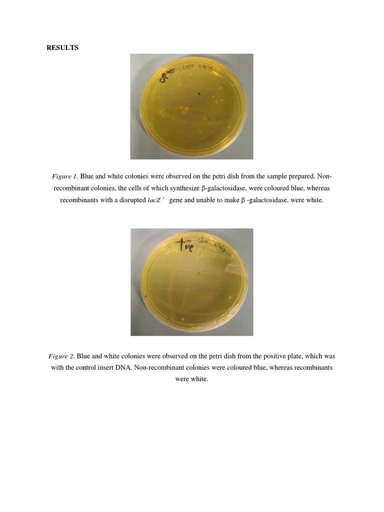 Results of Blue-White Screening to Identify Recombinant E. Coli ...