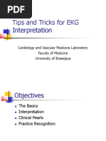 ICU One Pager External Pacemakers v11 | PDF | Artificial Cardiac ...