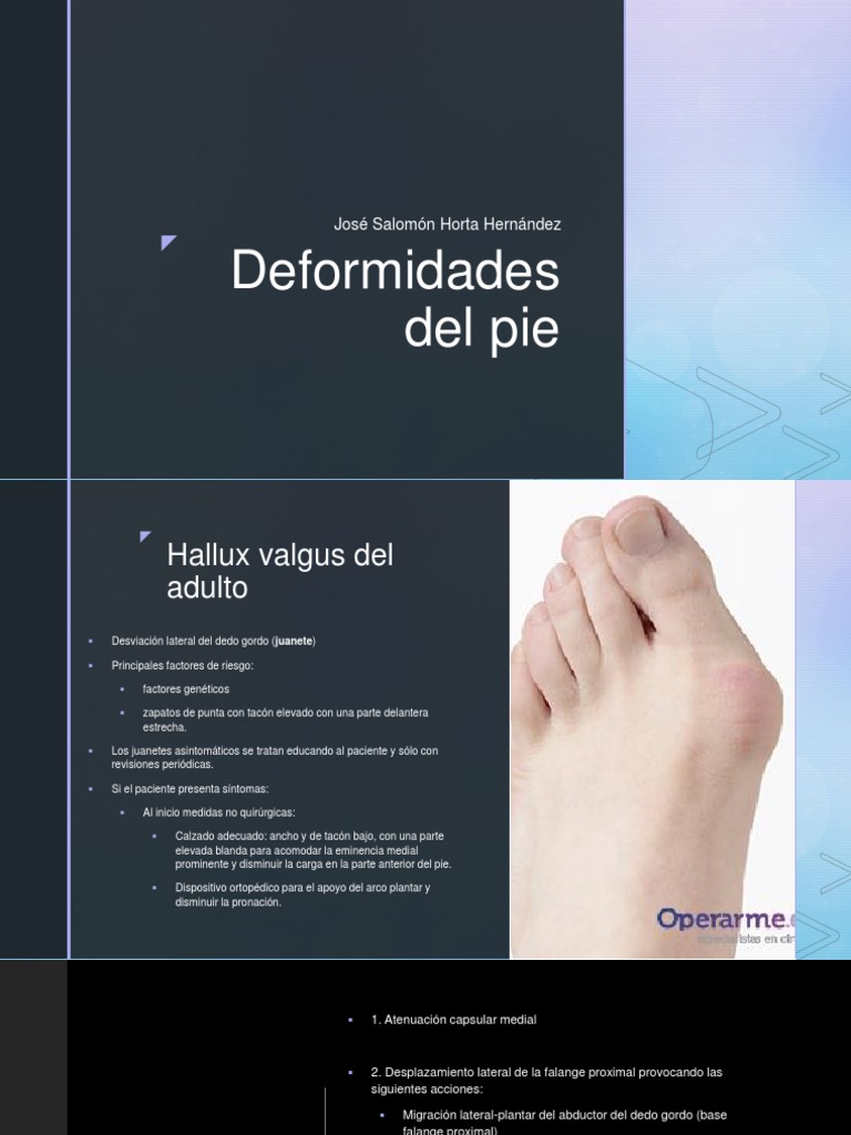 Deformidades Del Pie - Trauma | PDF | Dedo del pie | Pie