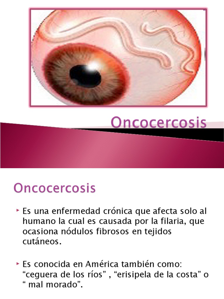 Oncocercosis Expo | PDF | Especialidades Medicas | Enfermedades y ...