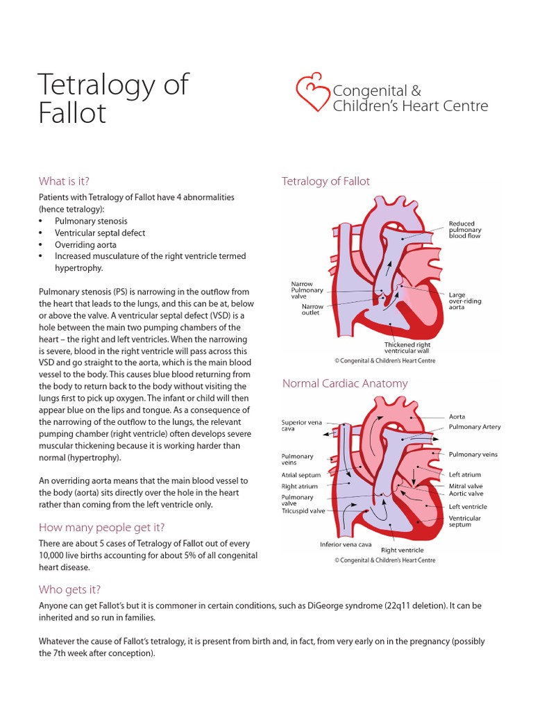 Tetralogy of Fallot | PDF | Ventricle (Heart) | Heart