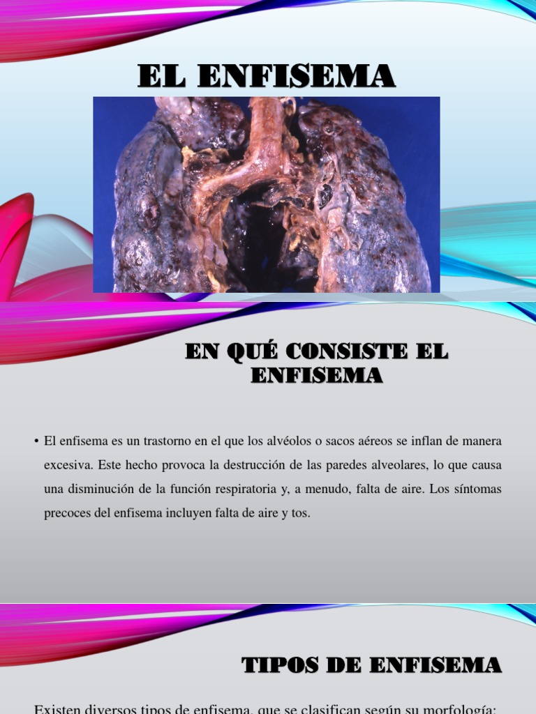 El Enfisema | Pulmón | Enfermedad pulmonar obstructiva crónica