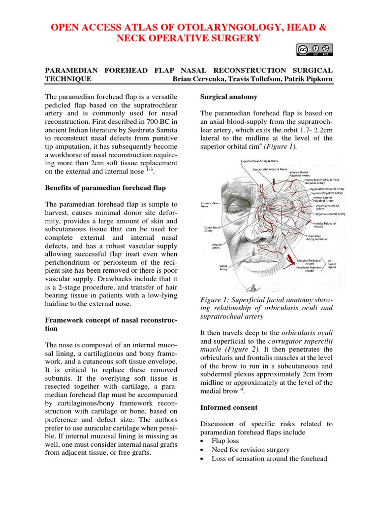 Paramedian Forehead Flap Nasal Reconstruction Surgical Technique | PDF ...