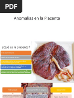 Fisiopatología Del Acv Isquémico | PDF | Carrera | Isquemia