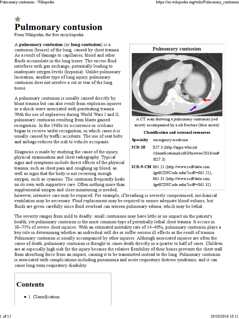 Pulmonary Contusion - Wikipedia | PDF | Lung | Thorax