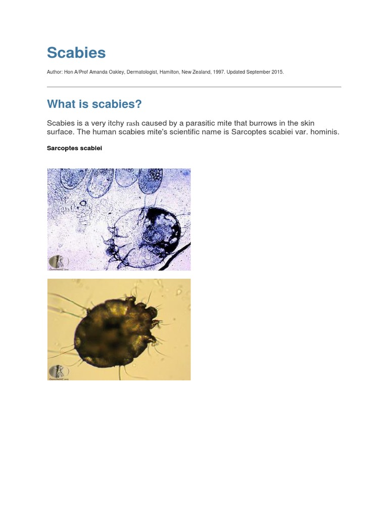 Scabies 1 | PDF | Medicine | Rtt