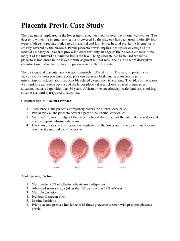 Placenta Previa Case Study | PDF | Mammalian Pregnancy | Motherhood