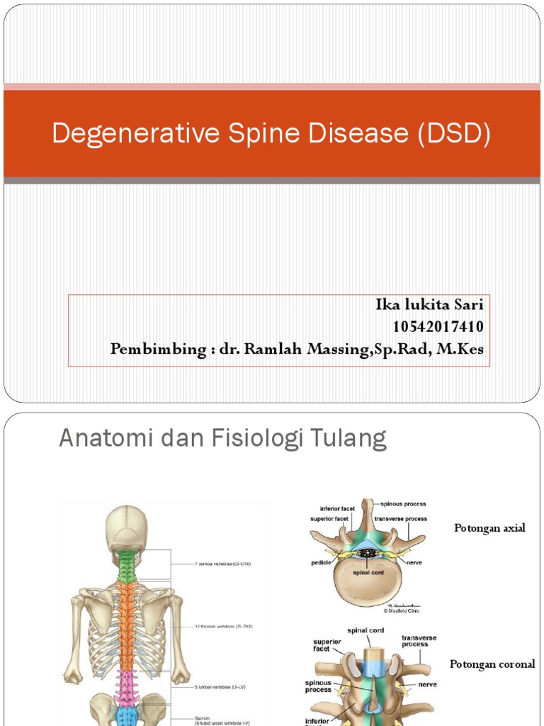 Degenerative Spine Disease (DSD) Fix Ika | PDF