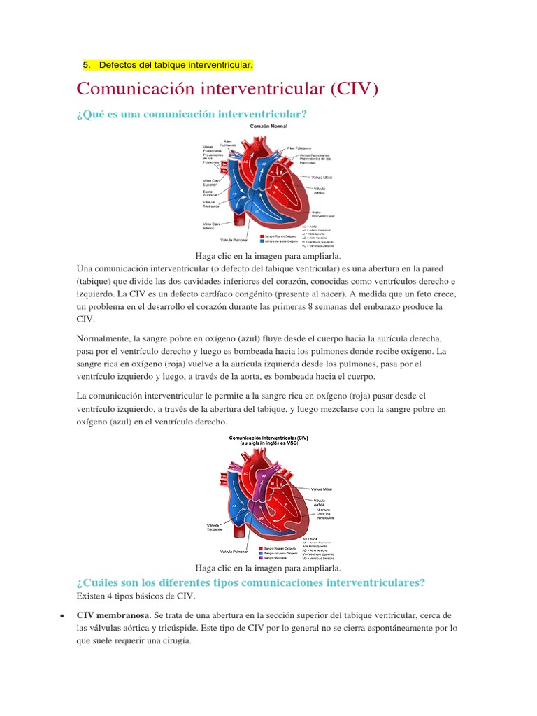 Defectos del Tabique Interventricular | PDF | Corazón | Pulmón