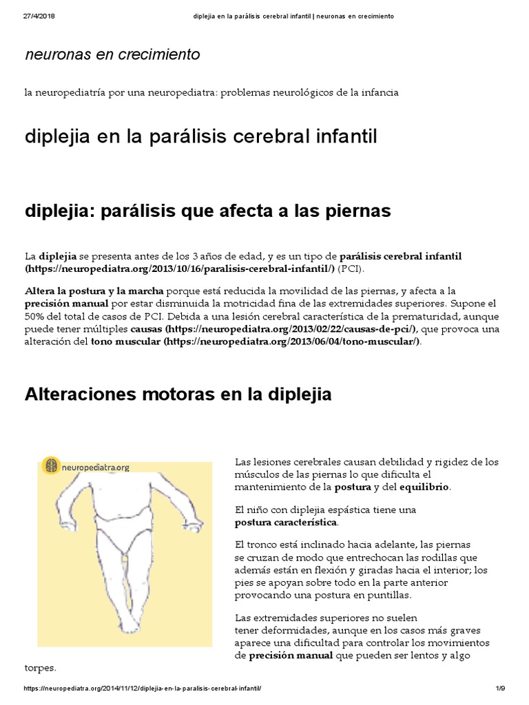 Diplejia en La Parálisis Cerebral Infantil _ Neuronas en Crecimiento ...