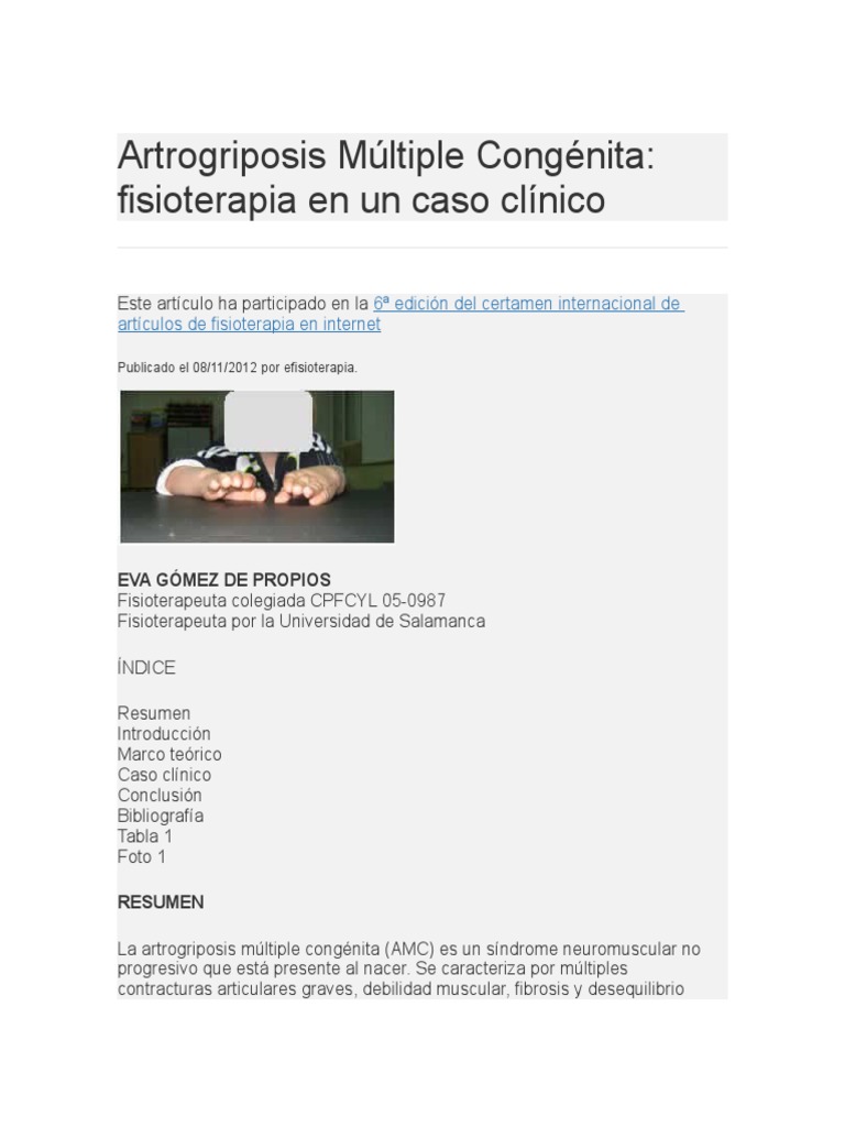 Artrogriposis Múltiple Congénita | PDF | Pie | Mano