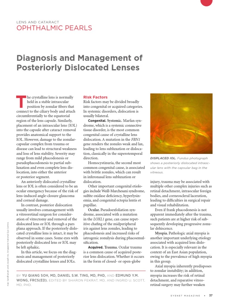 October 2017 Ophthalmic Pearls | PDF | Cornea | Eye