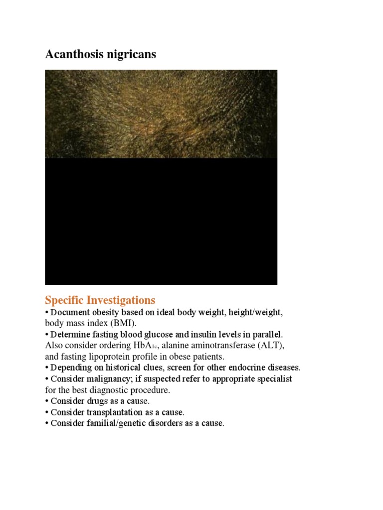 Acanthosis Nigricans: Specific Investigations | PDF