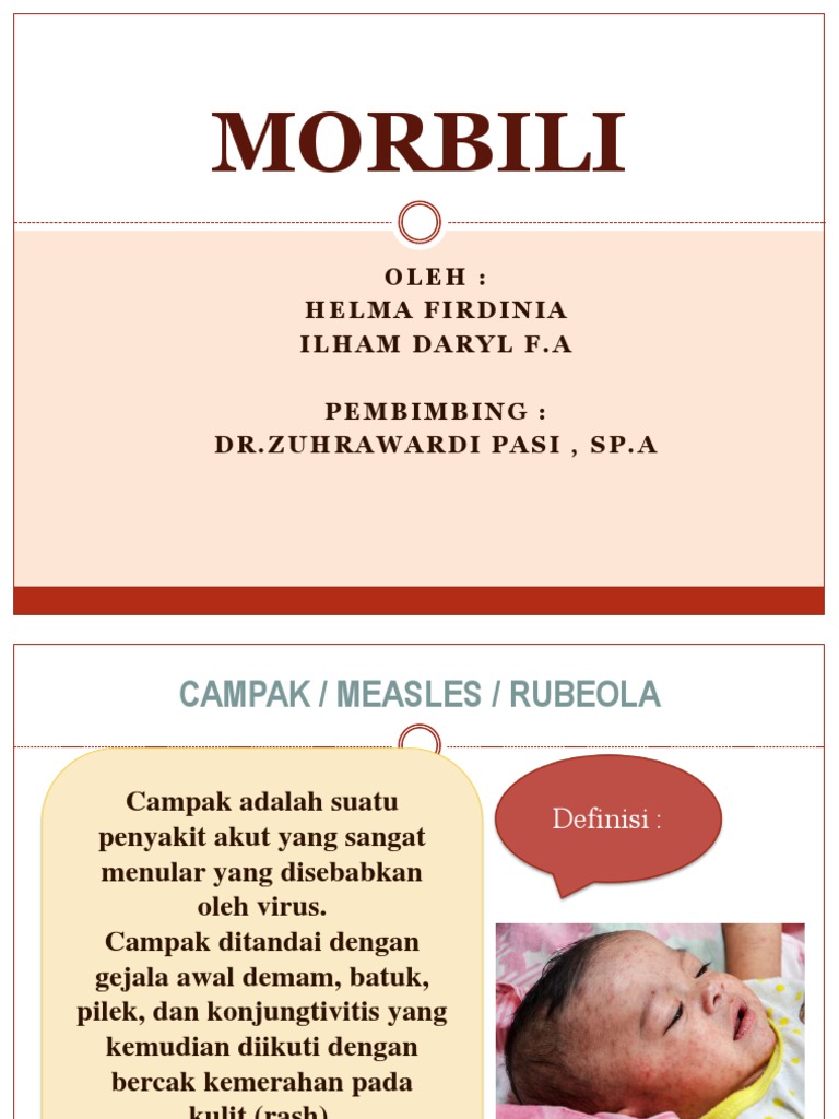Campak (Morbili) | PDF