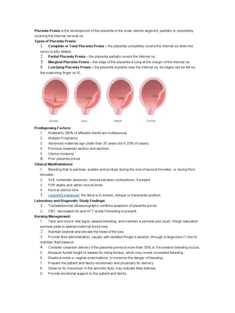Placenta Previa | PDF | Pregnancy | Placenta