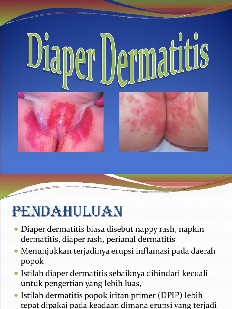 Diaper Dermatitis | PDF | Kesehatan Holistik | Sains & Matematika