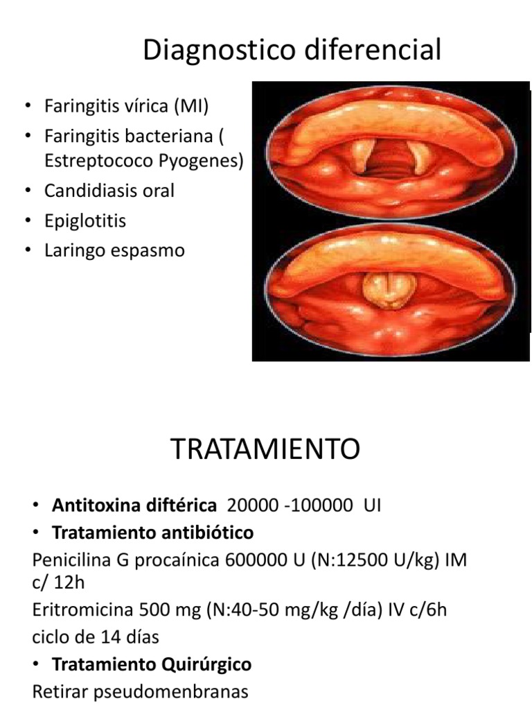 DIAPOSITIVAS DIFTERIA | Inmunología | Rtt