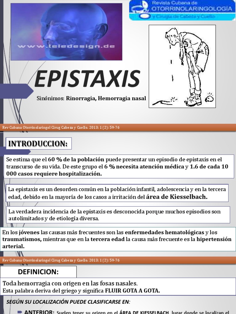 Epistaxis: Causas, Diagnóstico y Tratamiento | PDF | Ciencias de la ...