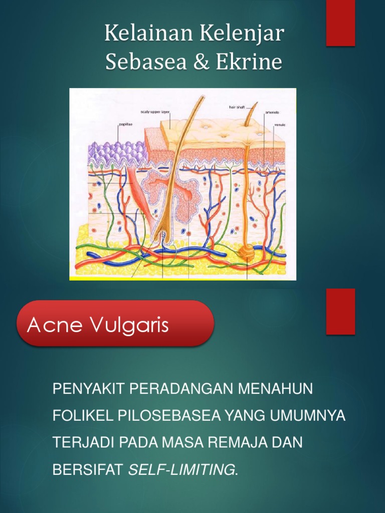 Kelainan Kelenjar Sebasea Dan Ekrin Edit | PDF