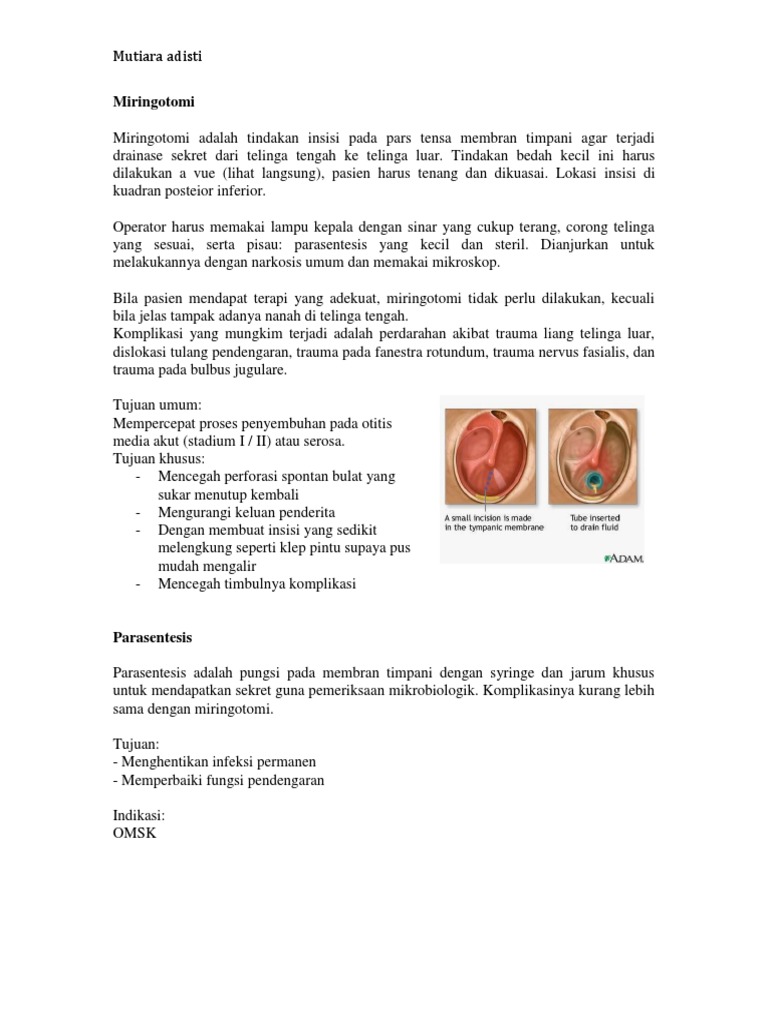 Perbedaan Miringotomi Dan Paracentesis, Kuadran MT - Mutiara Adisti | PDF