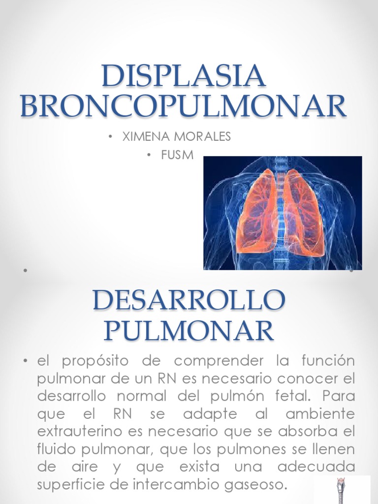 DISPLASIA BRONCOPULMONAR.ppt | Pulmón | Feto