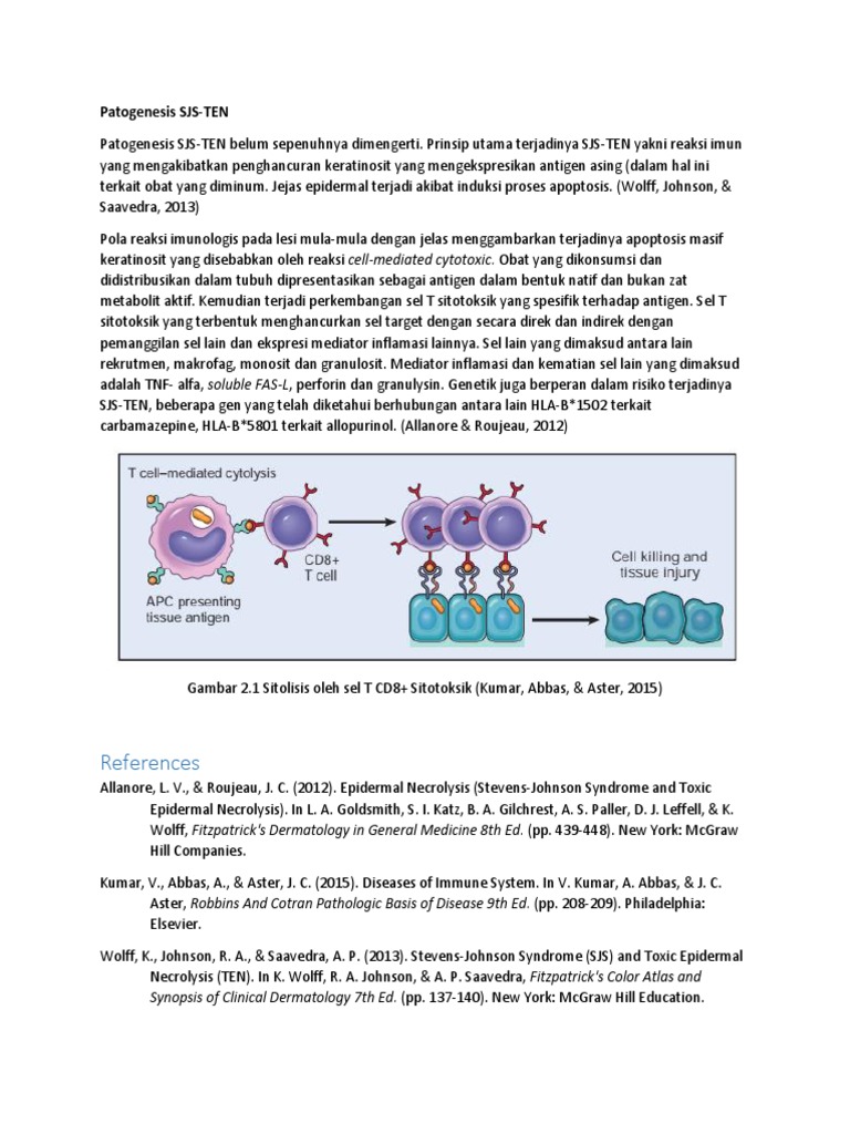 Patogenesis SJS TEN | PDF