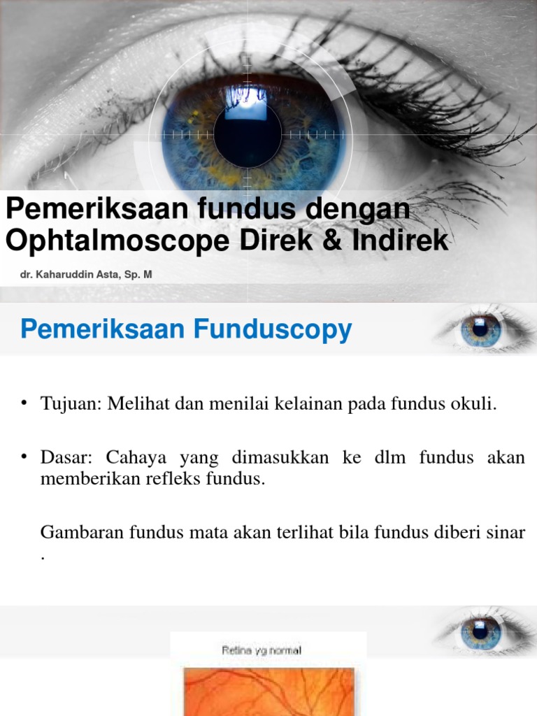 Fundus | PDF
