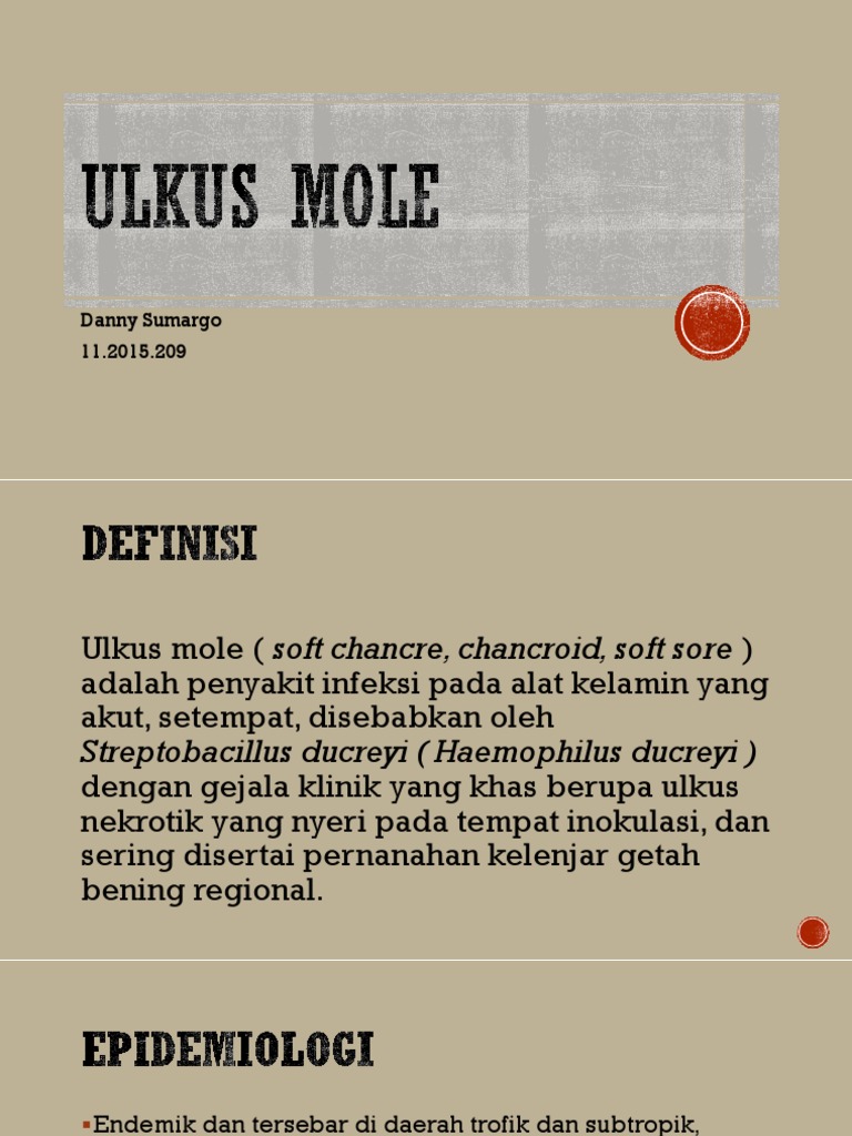 Ulkus Mole | PDF