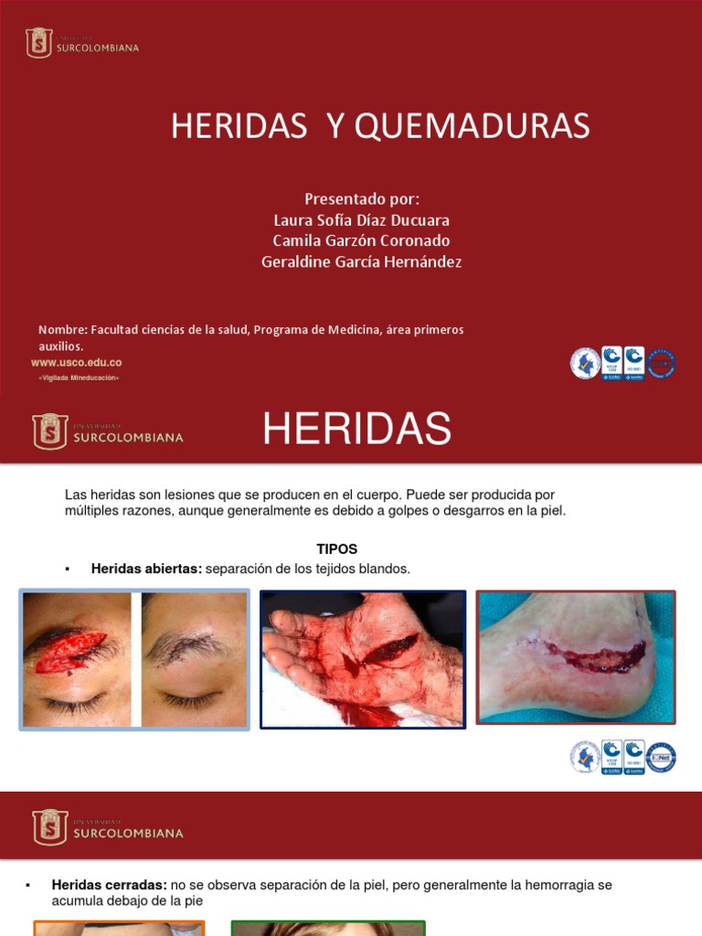 Heridas y Quemaduras | PDF | Quemar | Herida