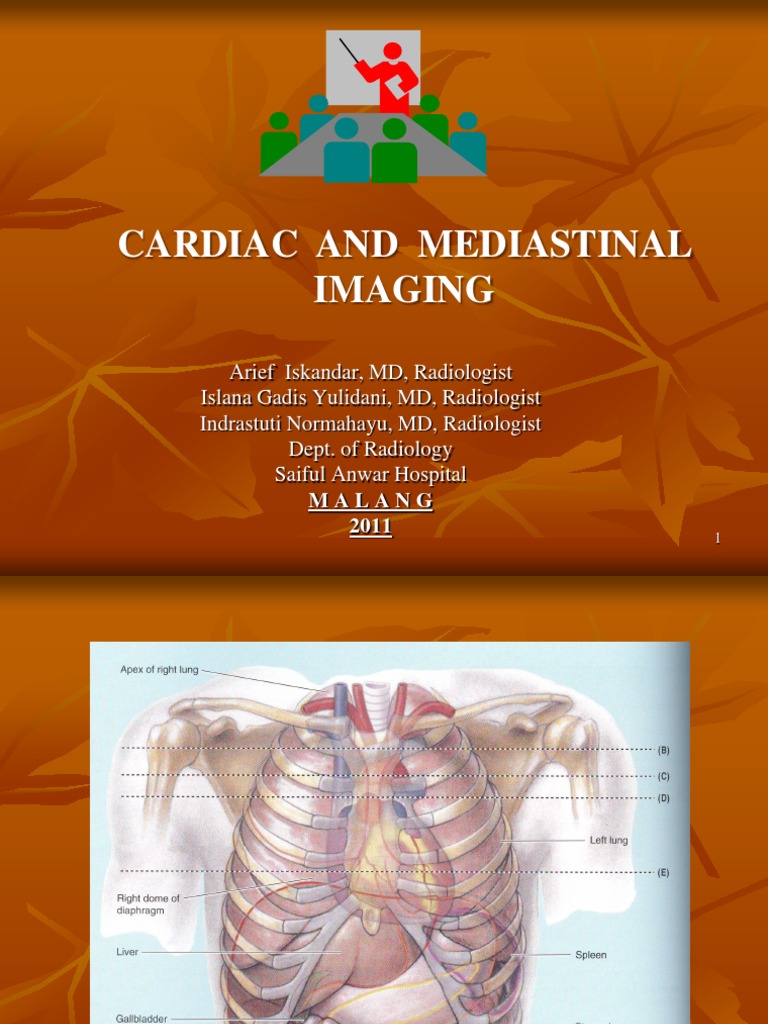 Cardiac Imaging Techniques | PDF | Ventricle (Heart) | Heart