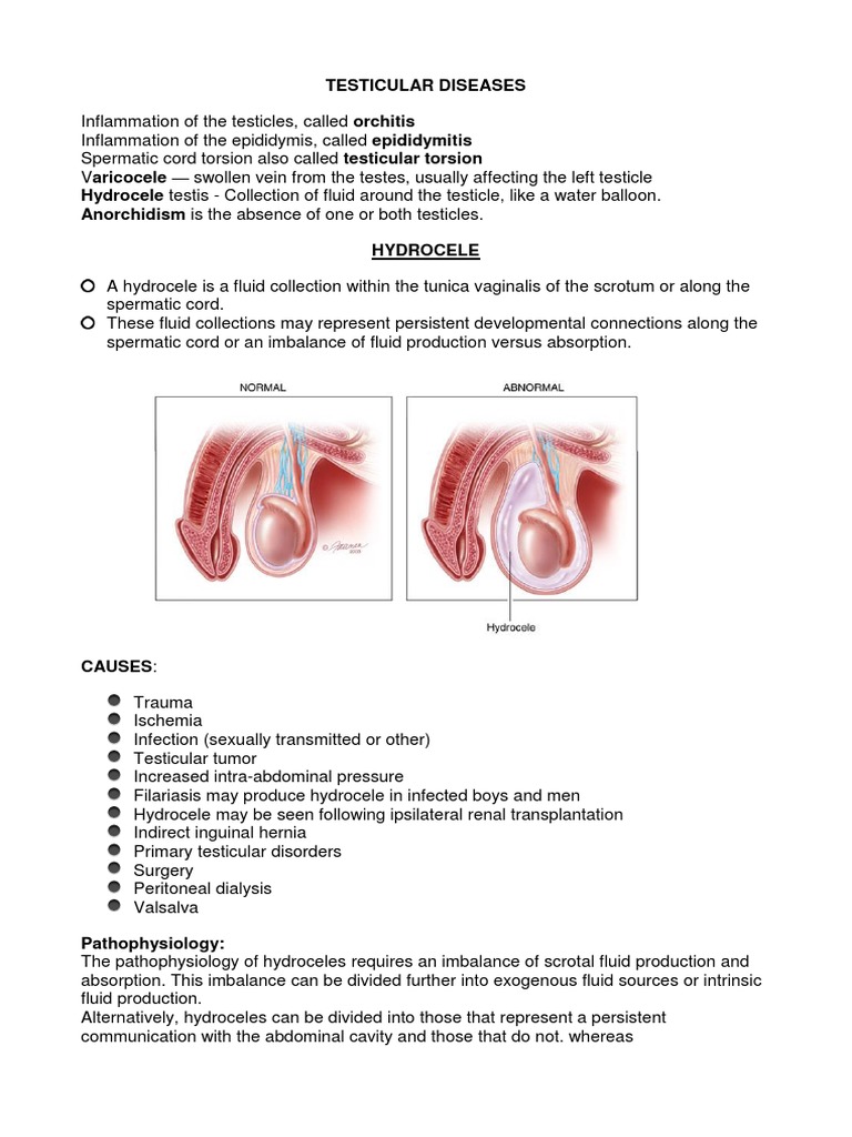 Testicular Diseases Orchitis Epididymitis Testicular Torsion Aricocele ...