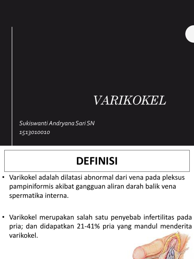 Varikokel | PDF