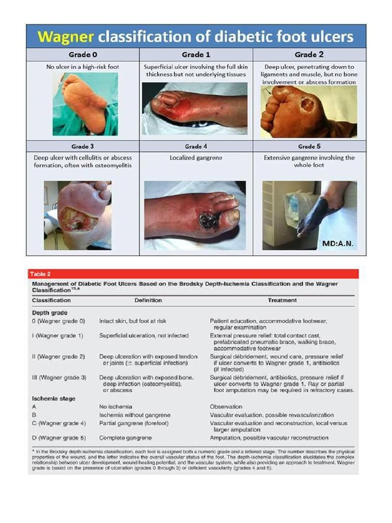 Diabetic Foot Wagner | PDF