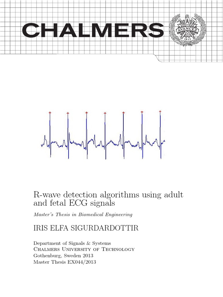 R-Wave Detection Algorithms ECG Signals | PDF | Filter (Signal ...