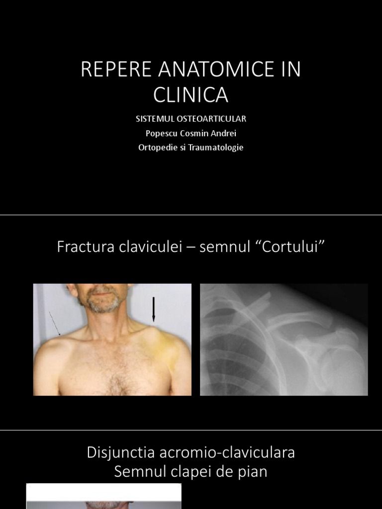 Repere Anatomice Osos | PDF